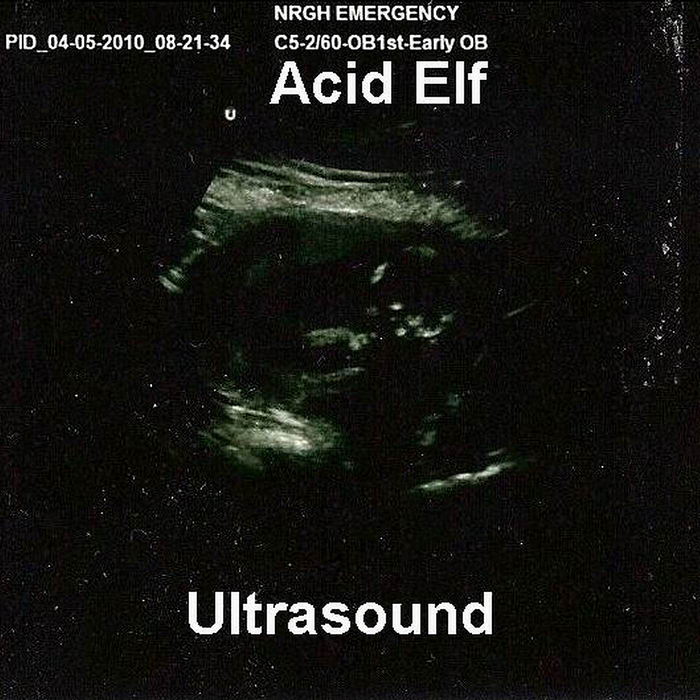 Ultrasound by Acid Elf on MP3, WAV, FLAC, AIFF & ALAC at Juno Download